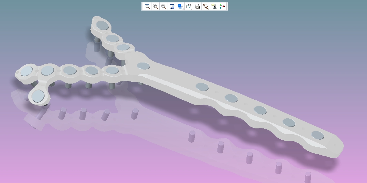 Primjena 3D tehnologija u medicini - 3D printanje - IZIT